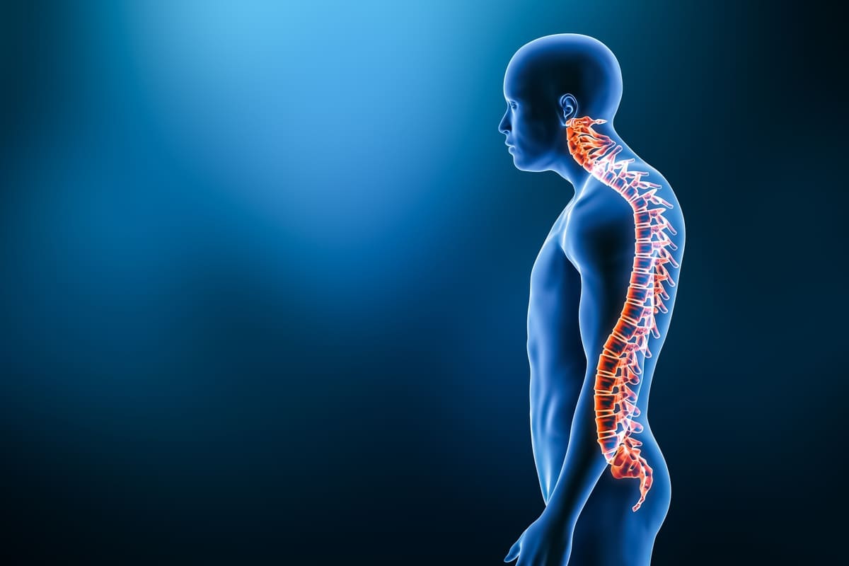 Exercitii pentru cifoza: indicatii si recomandari | Dr. Max Farmacie