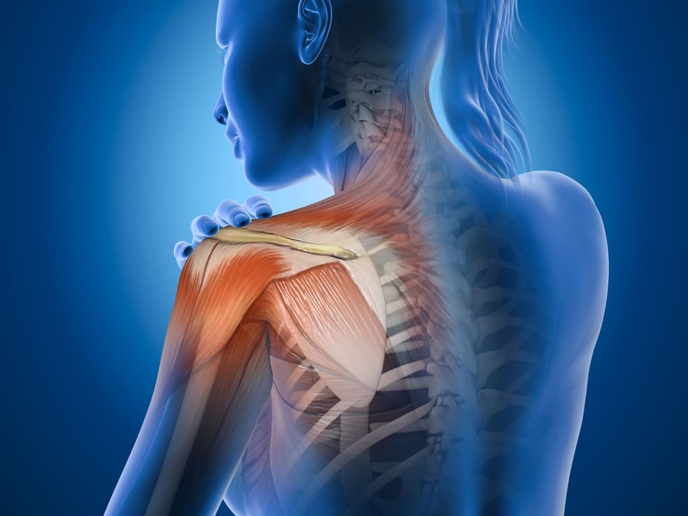 Impingement subacromial: cauze, simptome, tratament | Dr. Max Farmacie