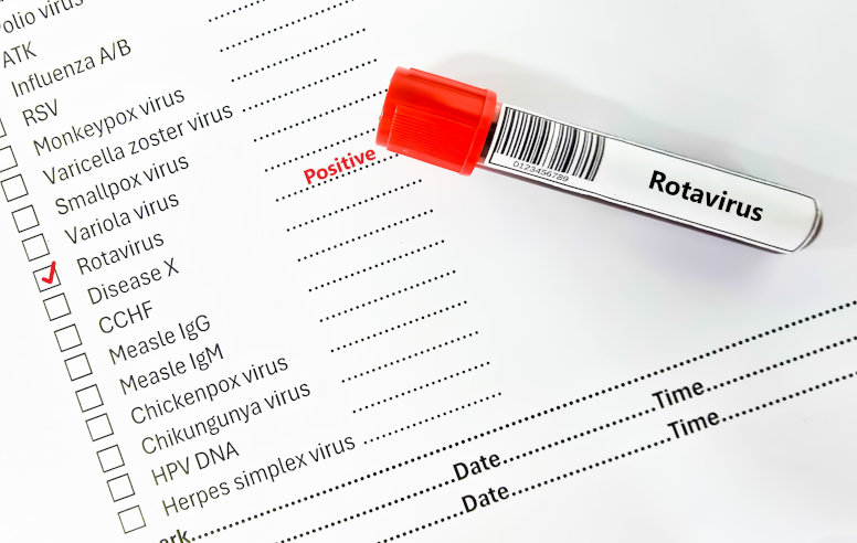 Co to jest rotawirus? Objawy zakażenia, leczenie i profilaktyka | Dr.Max